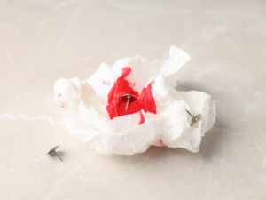 Hemorrhoid Bleeding, How Much Is Normal and What To Do